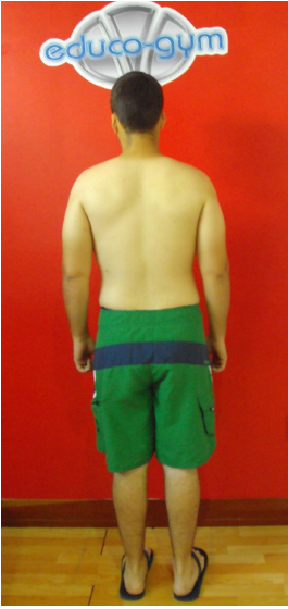 back after, yes i know i have shit posture. - #115045142 added by aeons ...